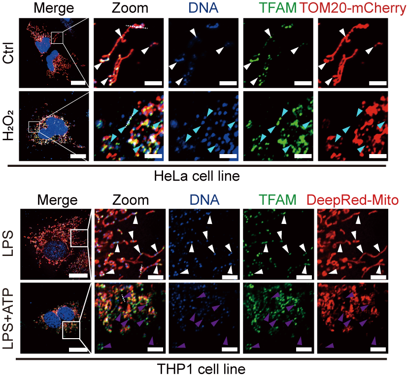 中心平台助力冯杜教授团队发现了一条不依赖于DNA酶的mtDNA降解通路，揭示了mtDNA质量控制的另一种机制-广州医科大学科研实验中心